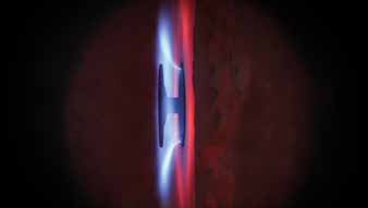 Process and Boiler Burner Upgrades, Retrofits, and Controls